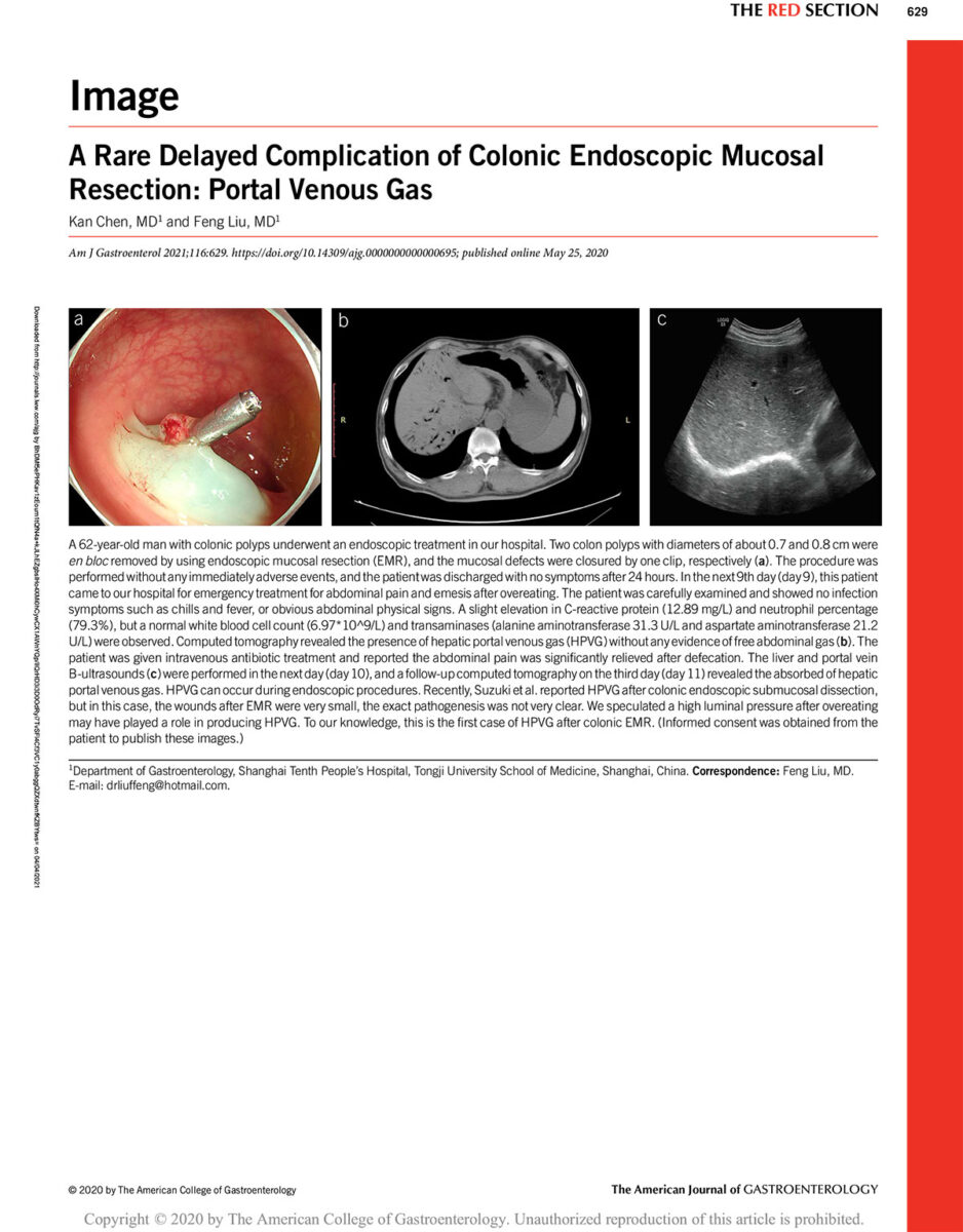 QUIZ: A Rare Delayed Complication of Colonic Endoscopic Mucosal ...